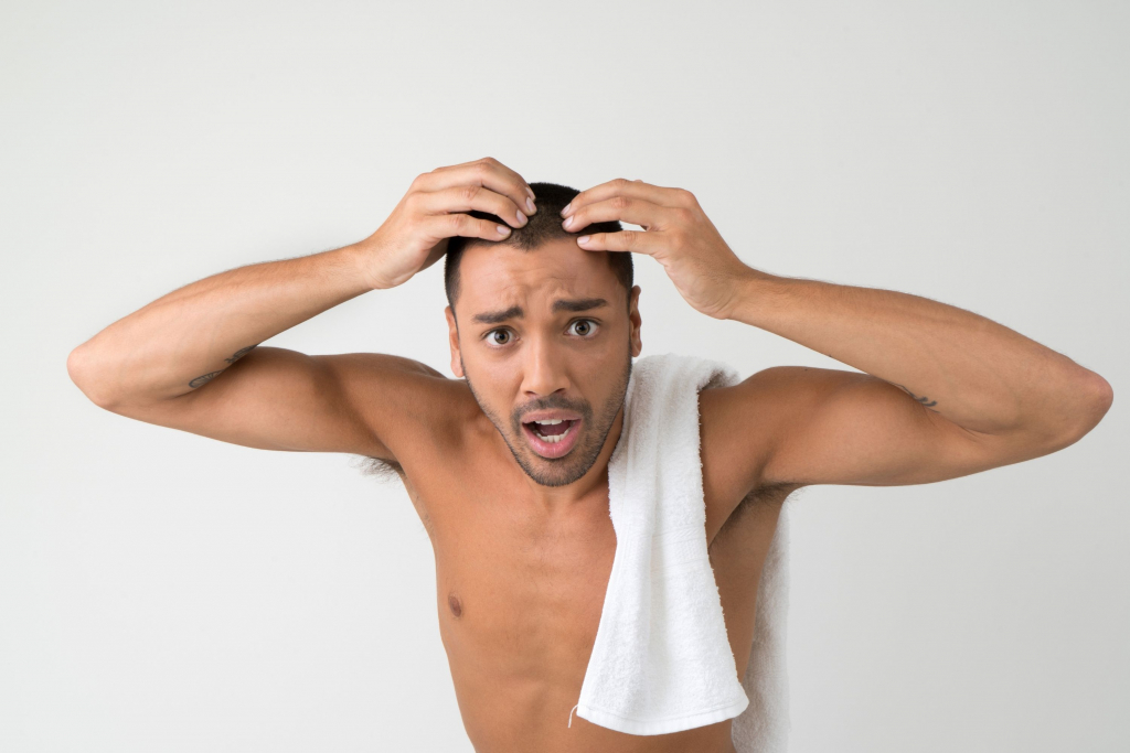 Going Bald A Brief Guide On Mens Hair Loss Beezzly